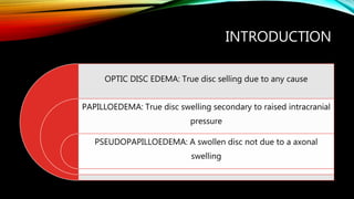 Evaluation of a patient with disc edema | PPTX