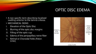 Evaluation of a patient with disc edema | PPTX