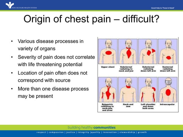 Evaluation of chest pain in primary care