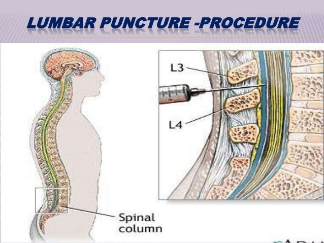Evaluation of csf