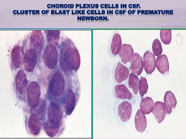 Evaluation Of Csf