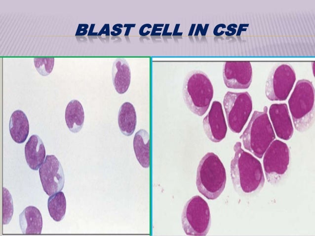 Evaluation of csf