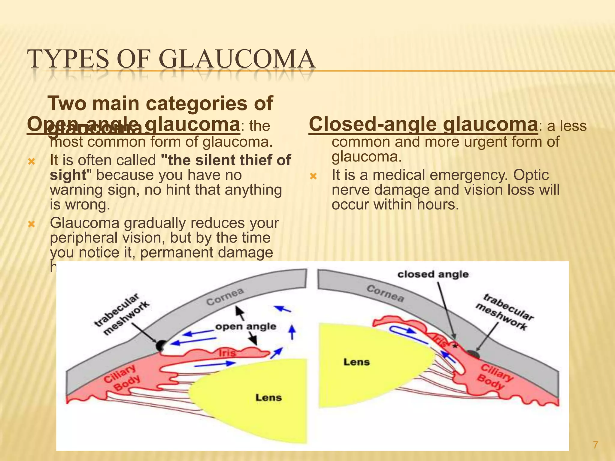 Evaluation of drugs acting on glaucoma & cataract by hiren | PPTX