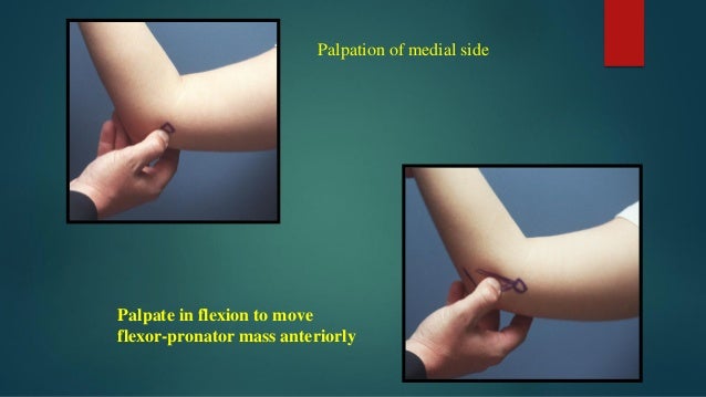 PS SESSION : ELBOW WRIST AND HAND EXAMINATION PART 1
