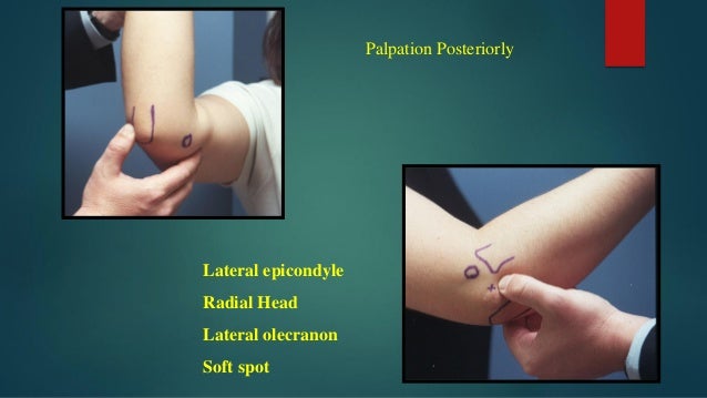 PS SESSION : ELBOW WRIST AND HAND EXAMINATION PART 1
