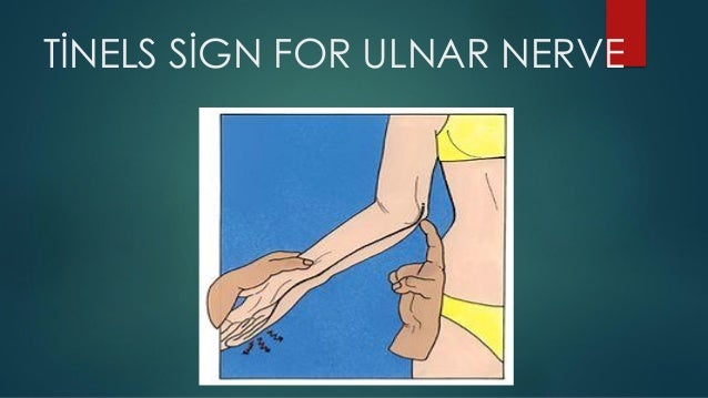 PS SESSION : ELBOW WRIST AND HAND EXAMINATION PART 1