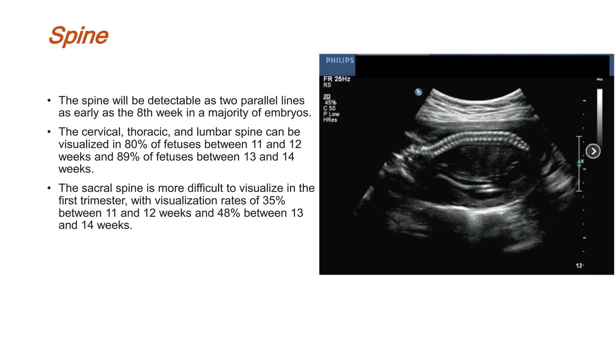 evaluation of fetal anatomy in 1st trimester.pptx