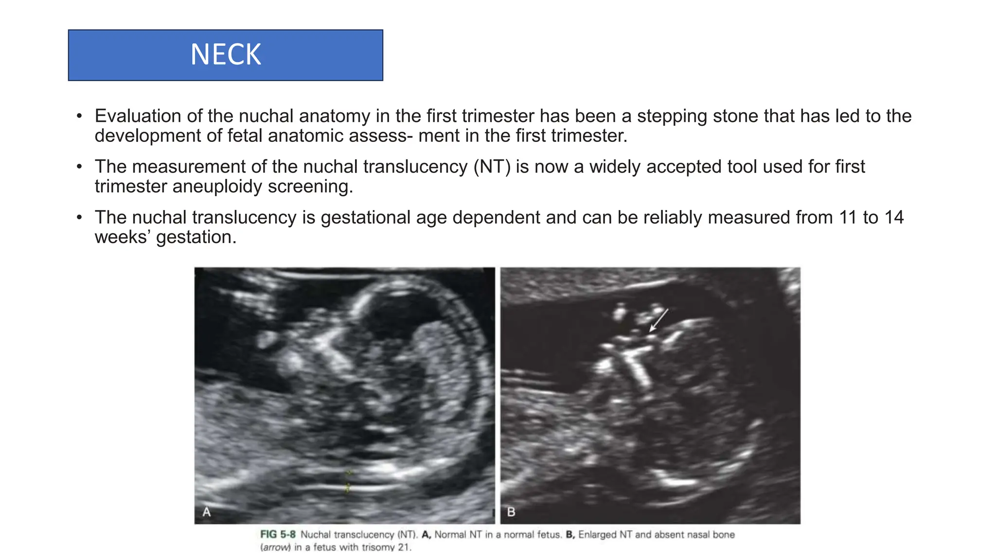 evaluation of fetal anatomy in 1st trimester.pptx
