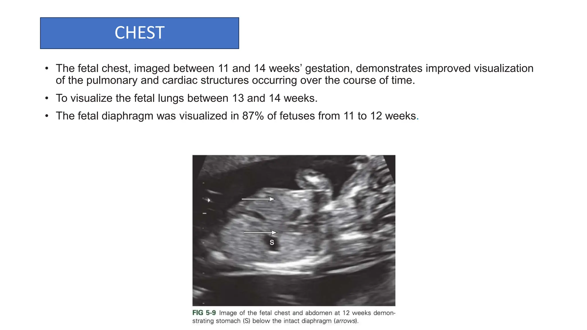 evaluation of fetal anatomy in 1st trimester.pptx