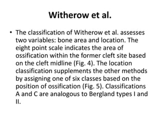 Evaluation of gpp | PPTX