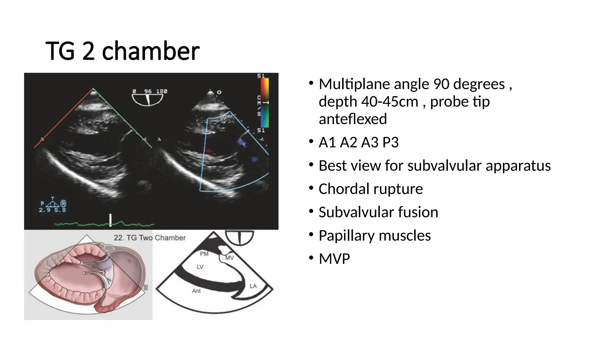evaluation of mitral valve -TEE approach.pptx