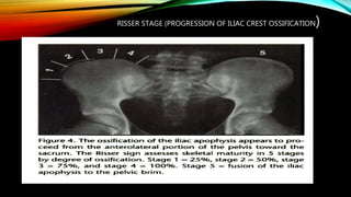 Evaluation of pediatric spinal deformities | PPT