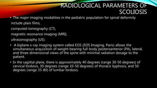 Evaluation of pediatric spinal deformities | PPTX