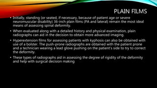 Evaluation of pediatric spinal deformities | PPTX