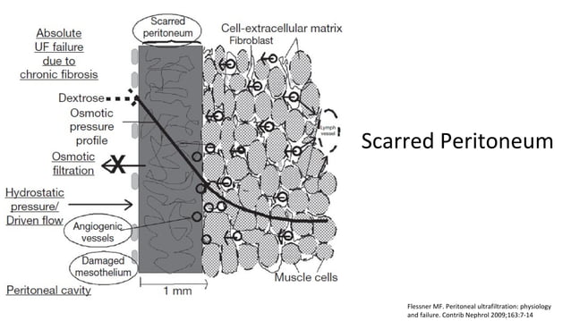 Evaluation of peritoneal membrane | PPT | Physics | Science
