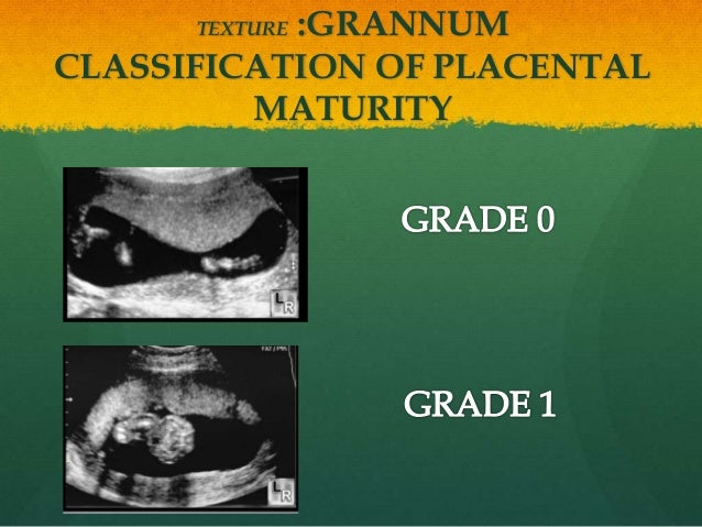 Radiological evaluation of the Placenta