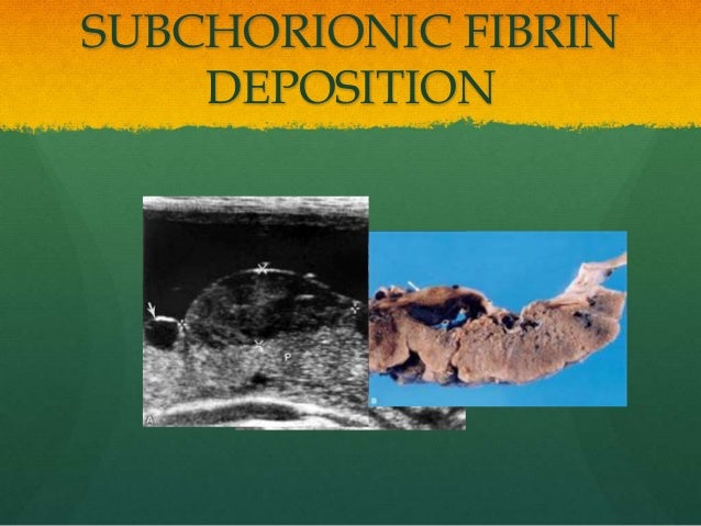 Radiological evaluation of the Placenta