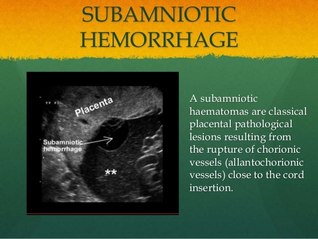 Radiological evaluation of the Placenta
