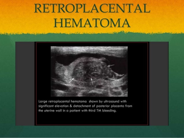 Radiological evaluation of the Placenta