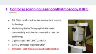 Evaluation of preperimetric glaucoma | PDF