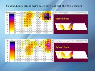 Evaluation Of Pressure Distribution of kybun Shoes | PPT