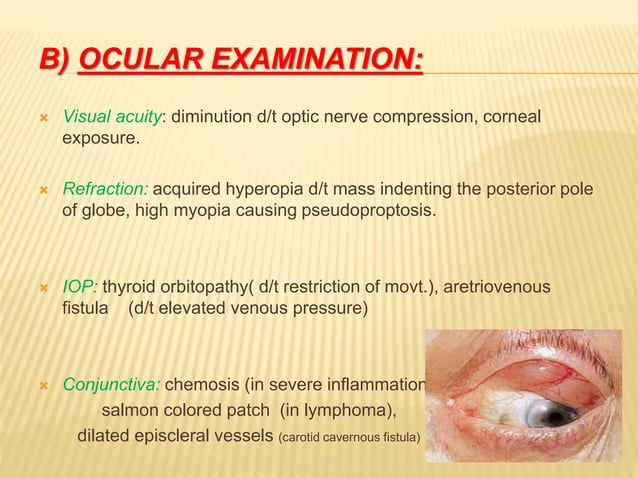Evaluation of proptosis | PPTX | Eye and Vision Conditions | Diseases ...