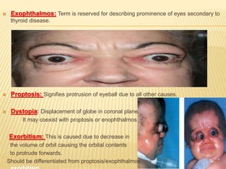 Evaluation of proptosis | PPTX