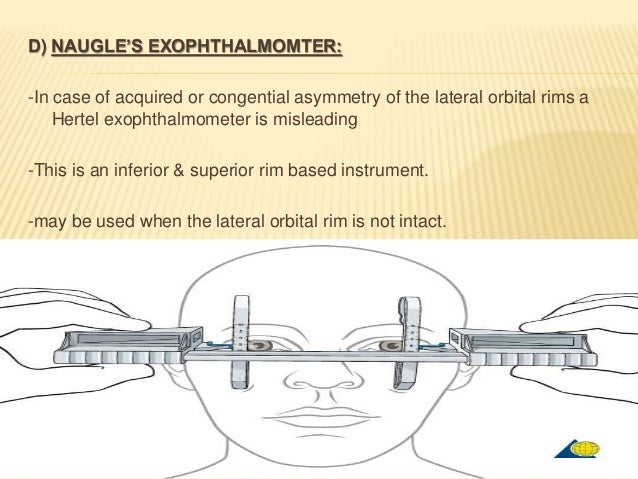 Evaluation of proptosis