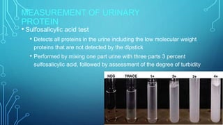 Evaluation of proteinuria in children - by Dr.B.Sivakanth | PPT