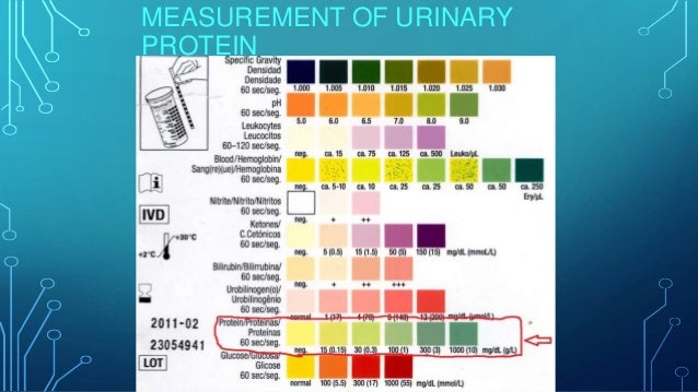 Evaluation of proteinuria in children - by Dr.B.Sivakanth