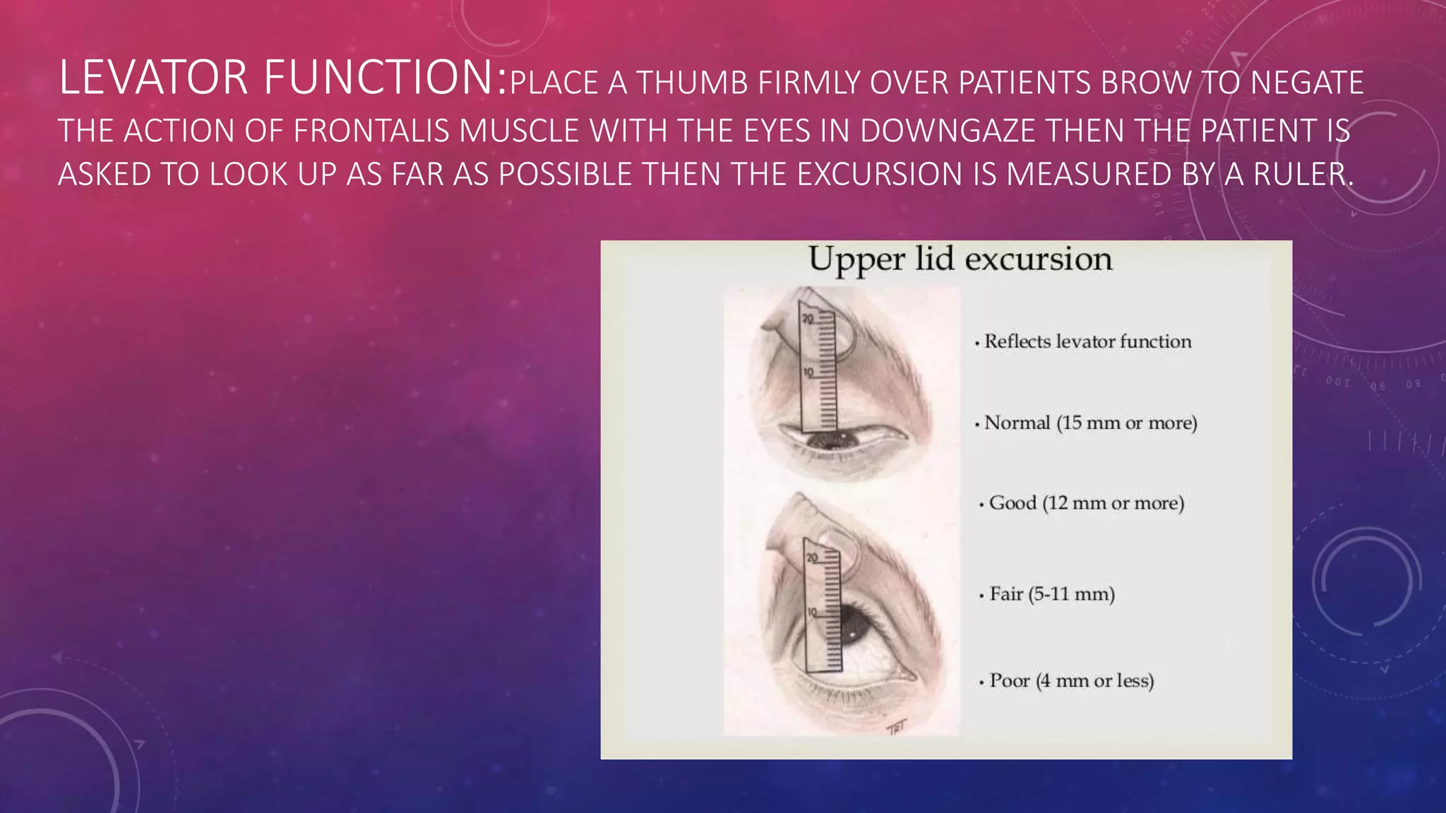 Evaluation of ptosis | PPTX