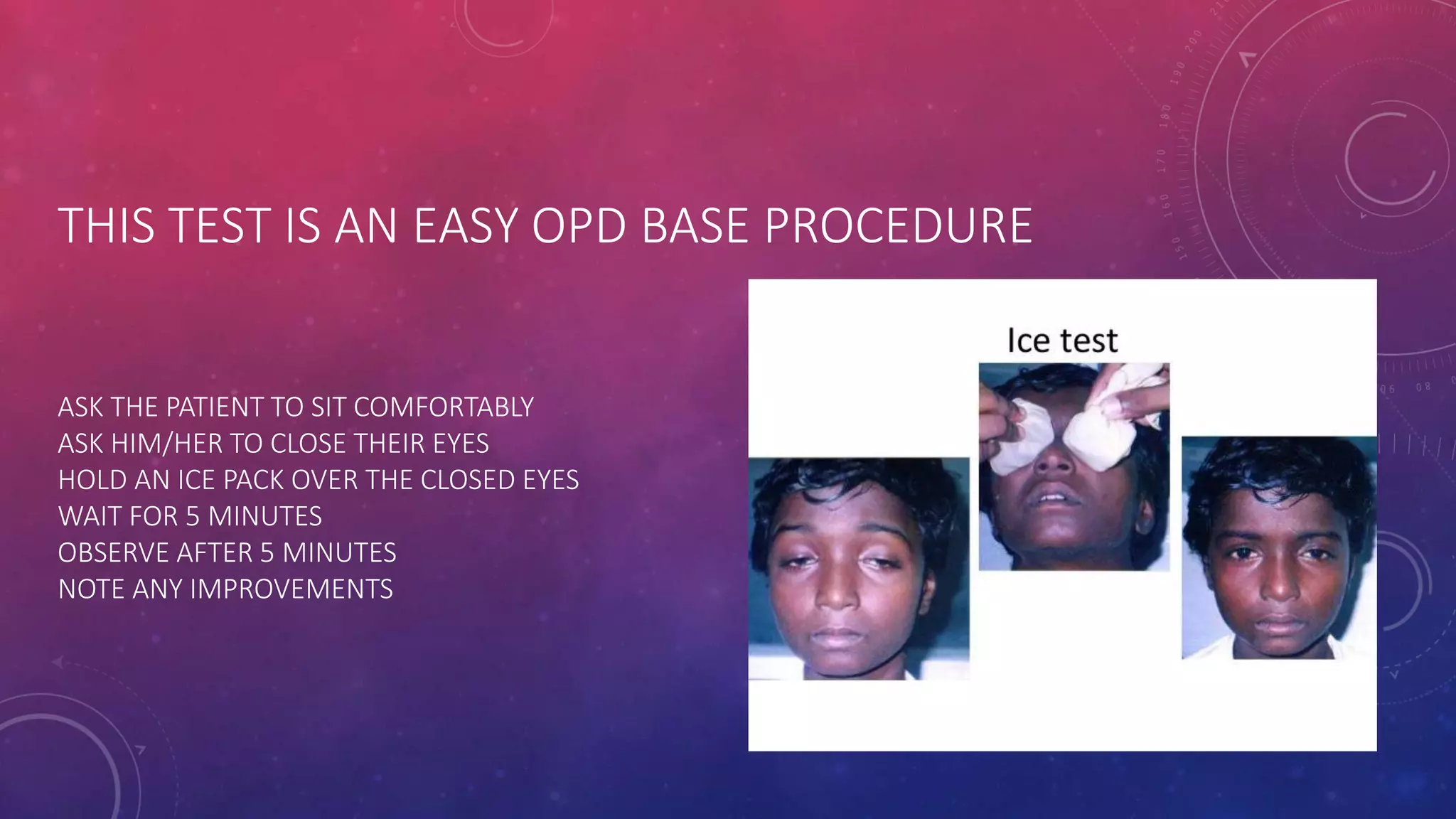 Evaluation of ptosis | PPTX