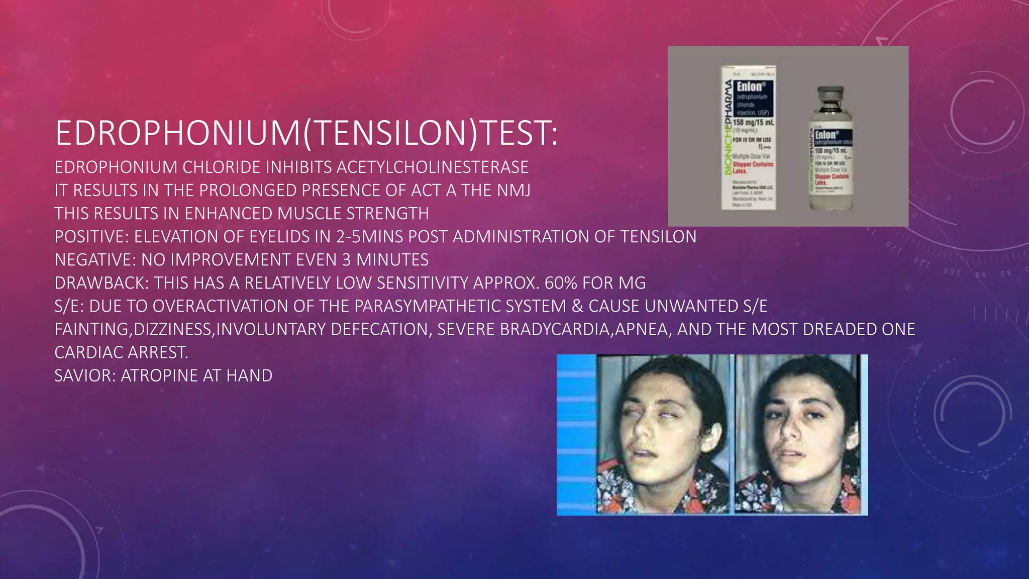 Evaluation of ptosis | PPTX