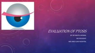 Evaluation of ptosis | PPTX