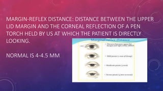 Evaluation of ptosis | PPTX