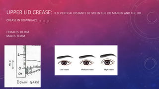 Evaluation of ptosis | PPTX