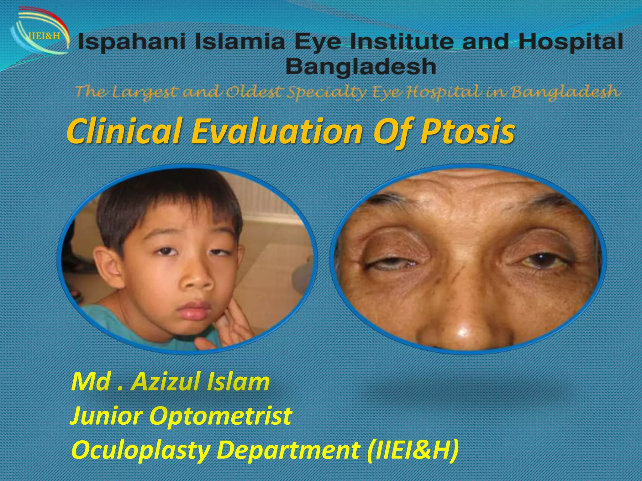 Ptosis workup | PPTX