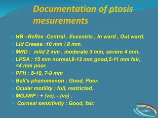 Ptosis workup | PPTX