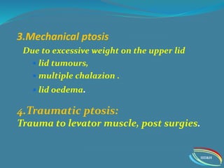 Ptosis workup | PPTX