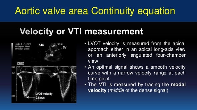 Evaluation of severity of as