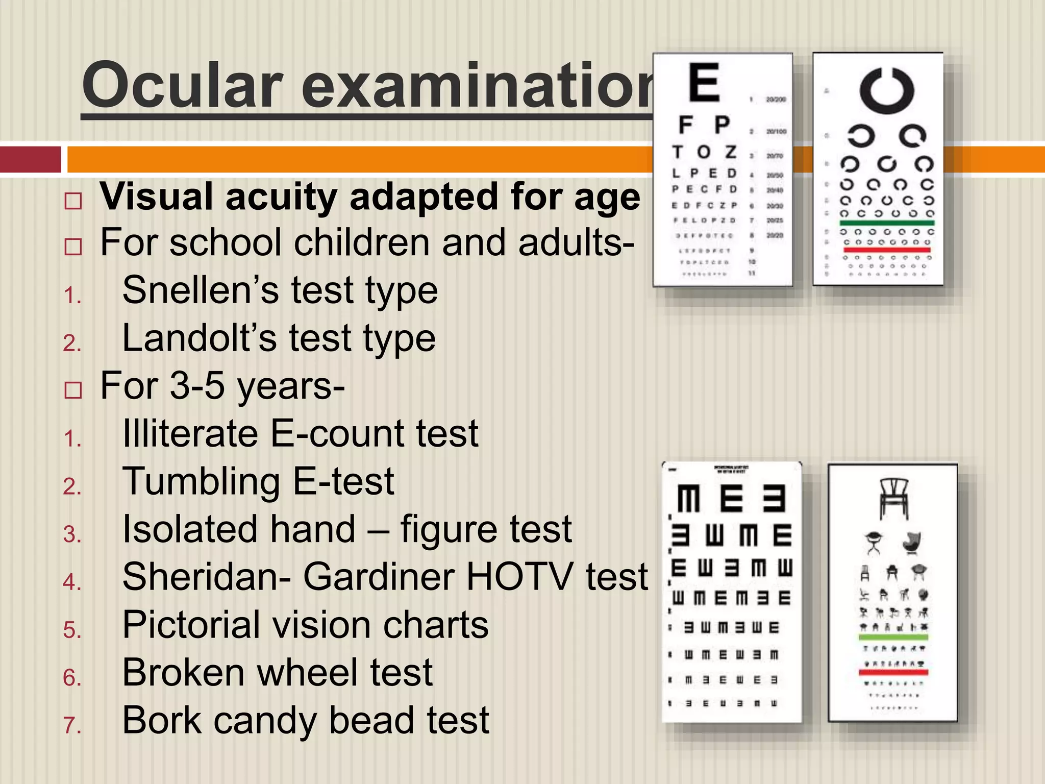 Evaluation of squint | PPTX
