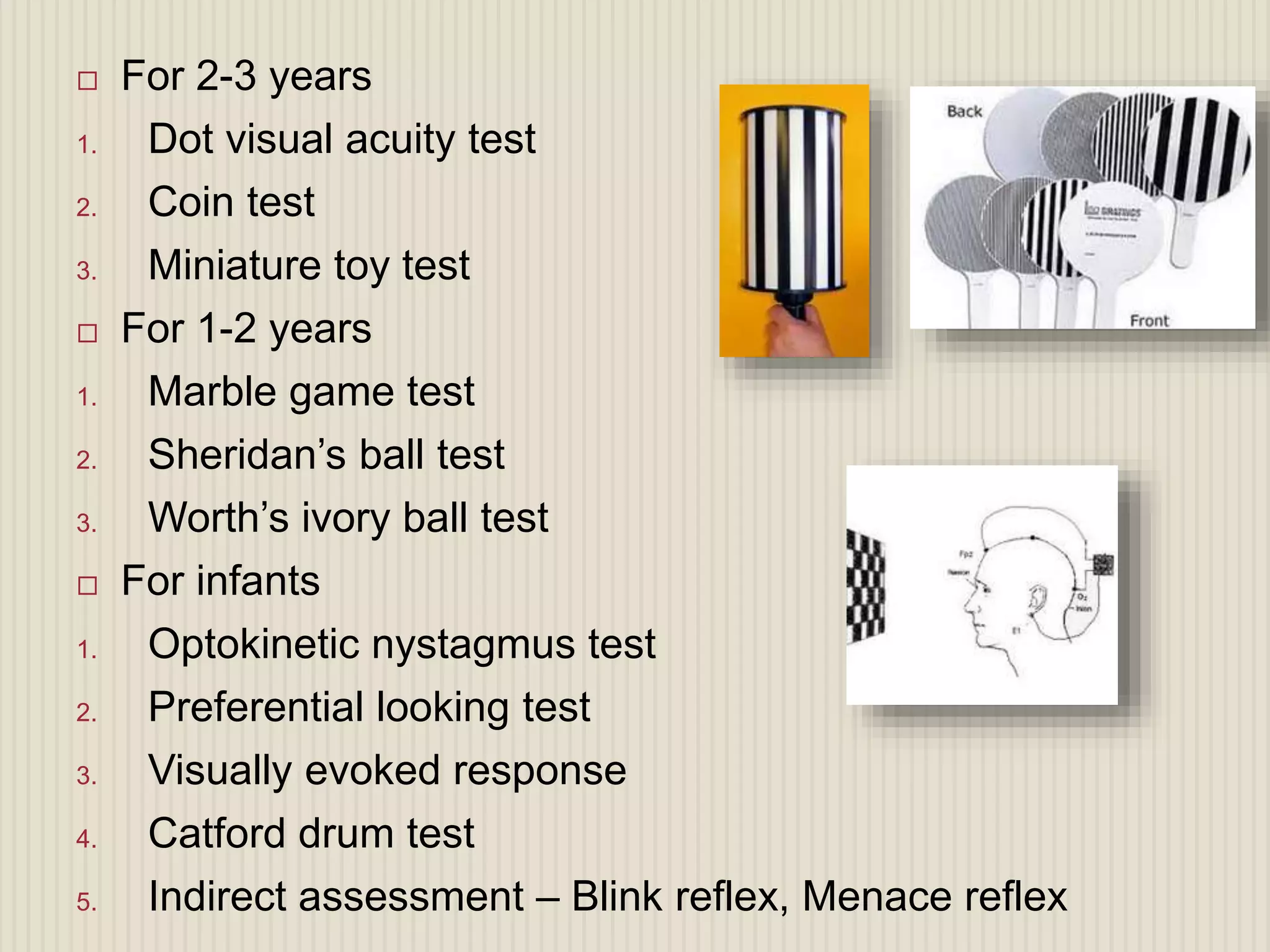 Evaluation of squint | PPTX