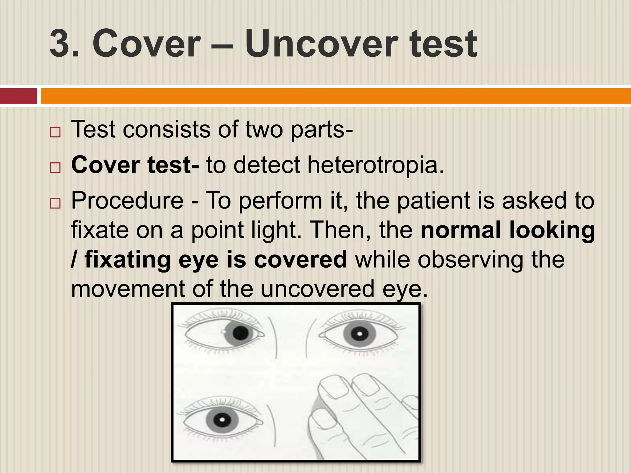 Evaluation of squint | PPTX