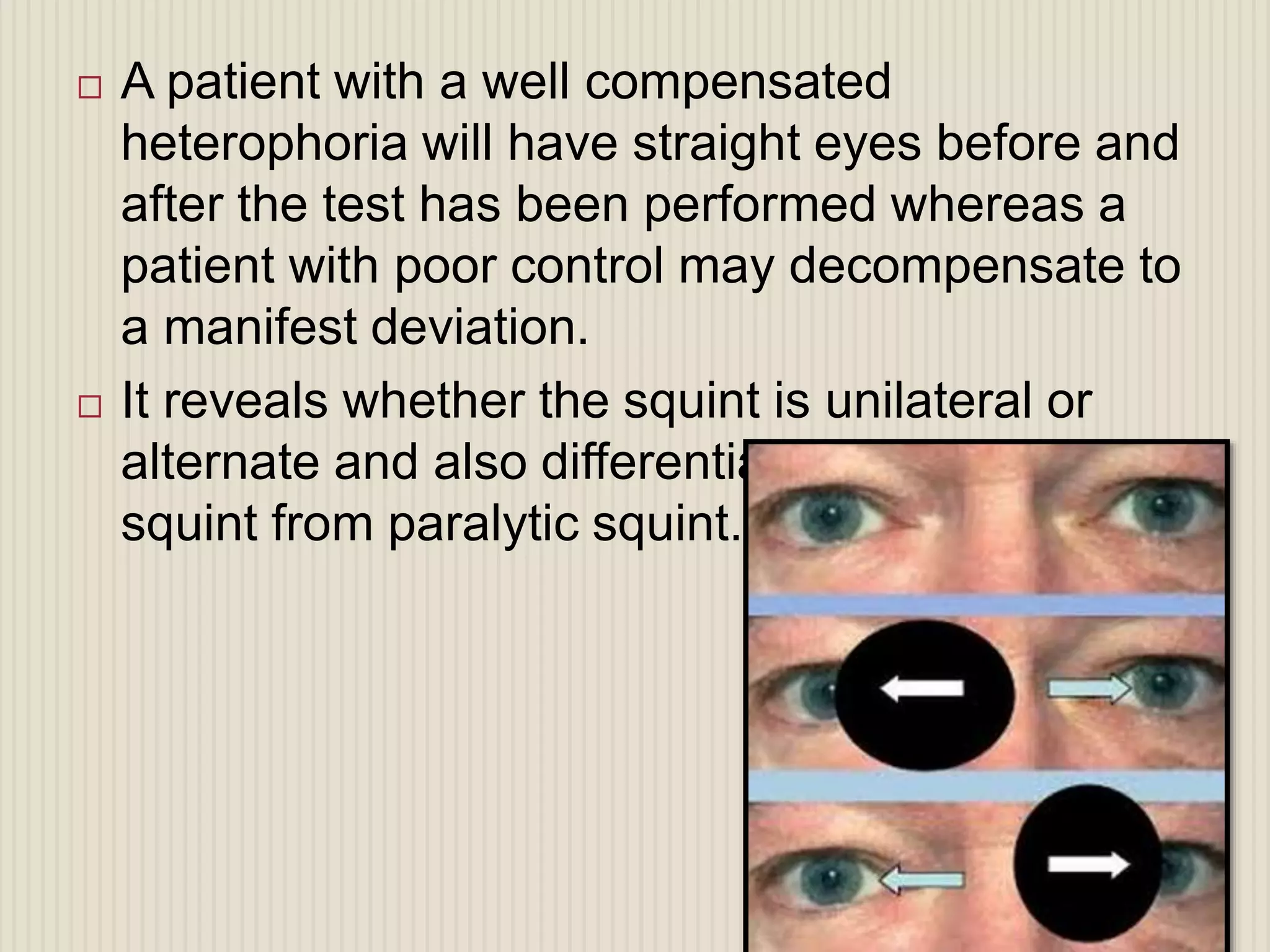 Evaluation of squint | PPTX