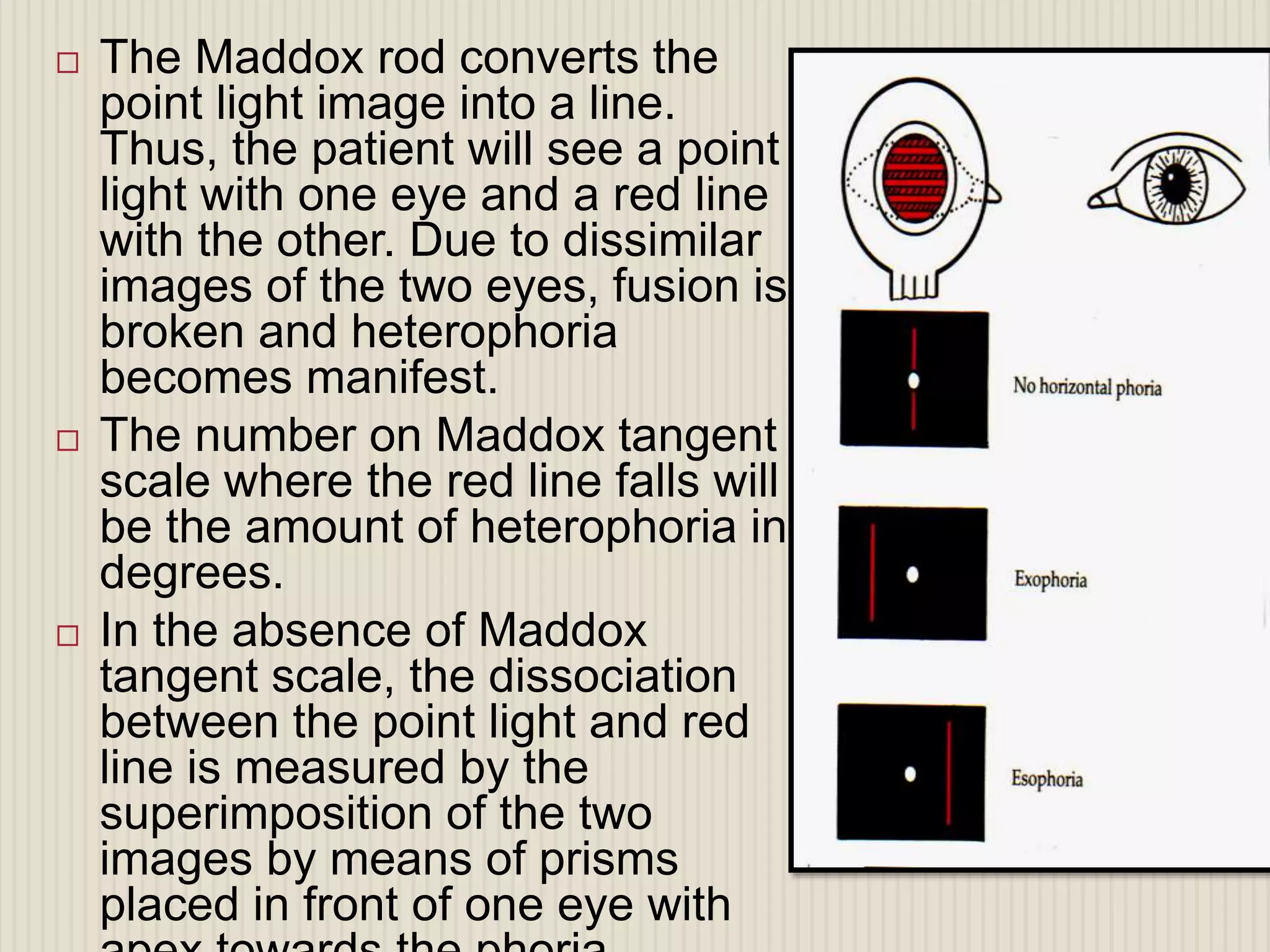Evaluation of squint | PPTX