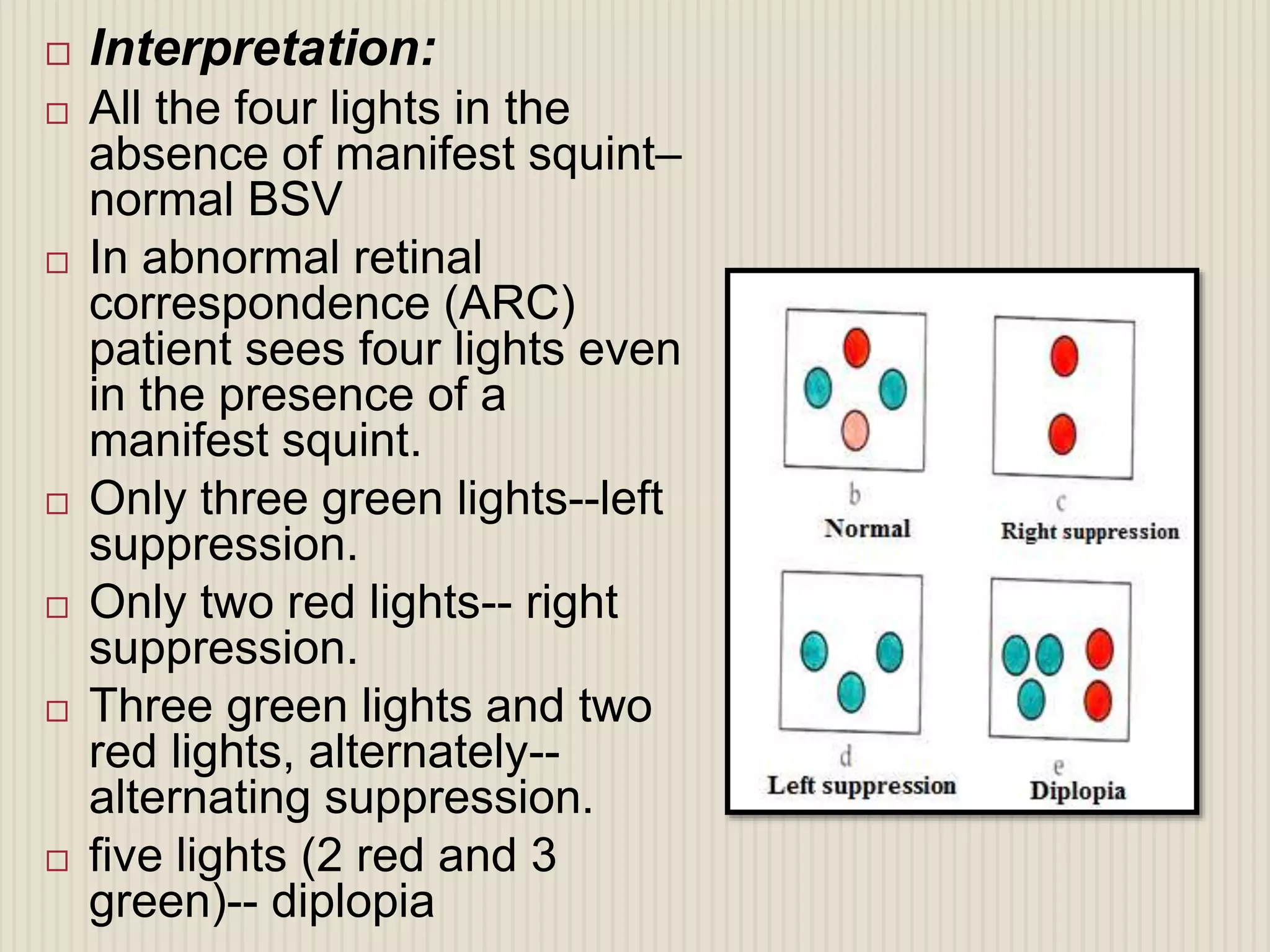 Evaluation of squint | PPTX