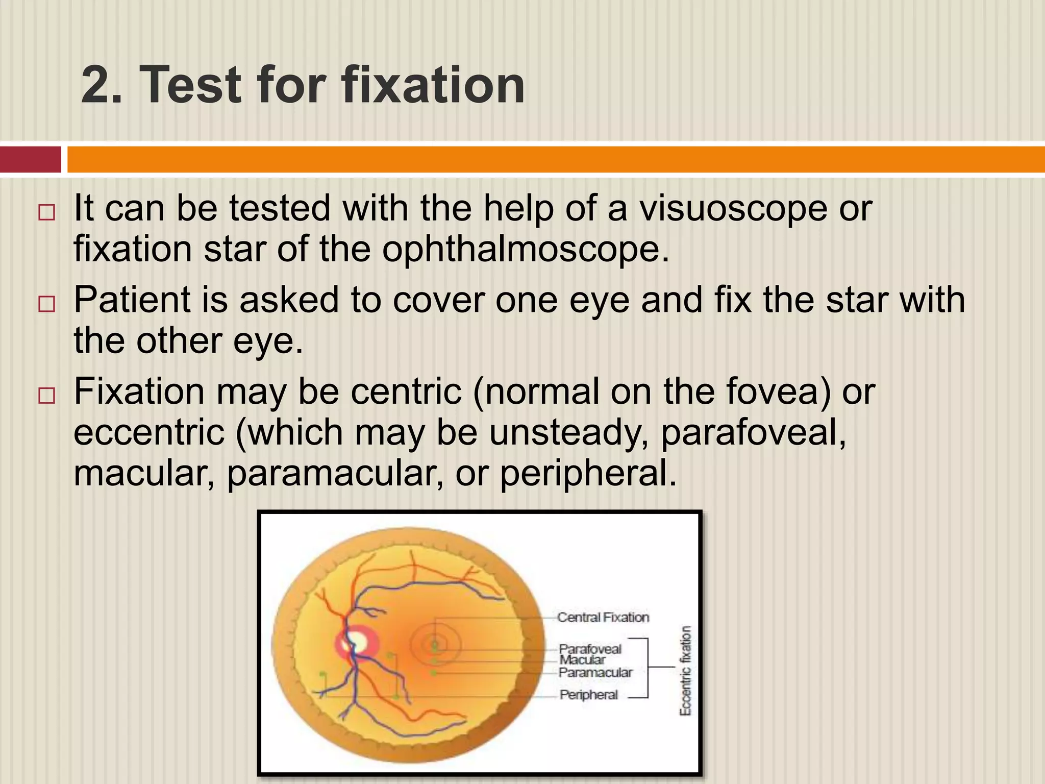 Evaluation of squint | PPTX