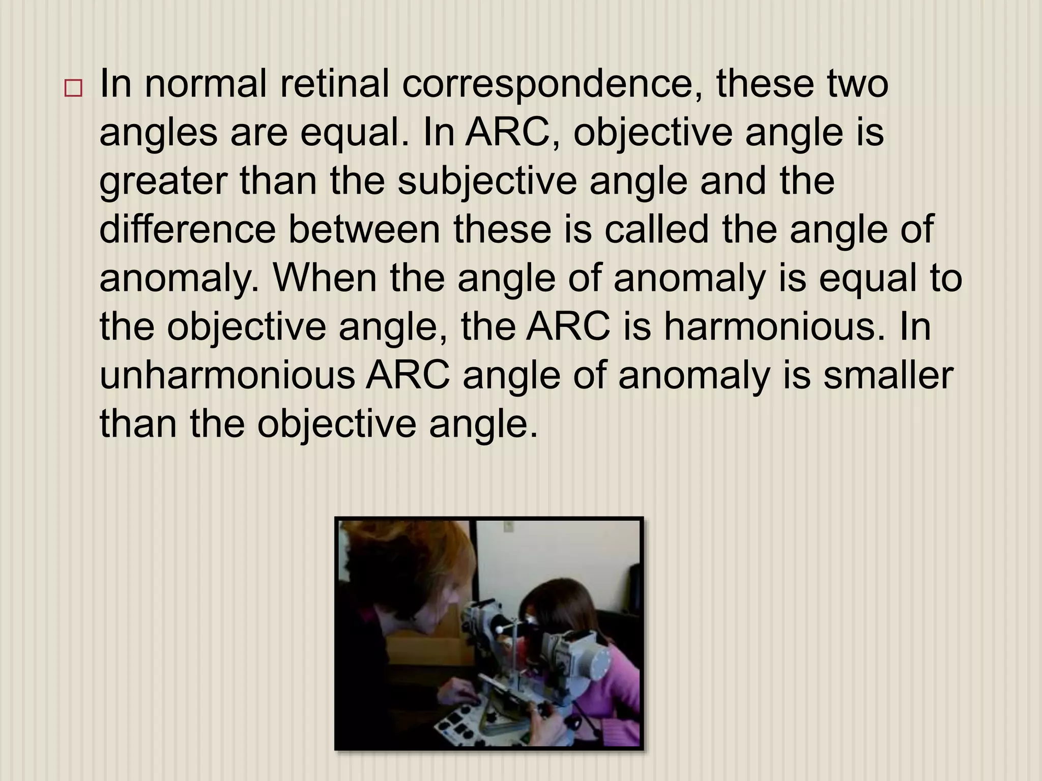 Evaluation of squint | PPTX