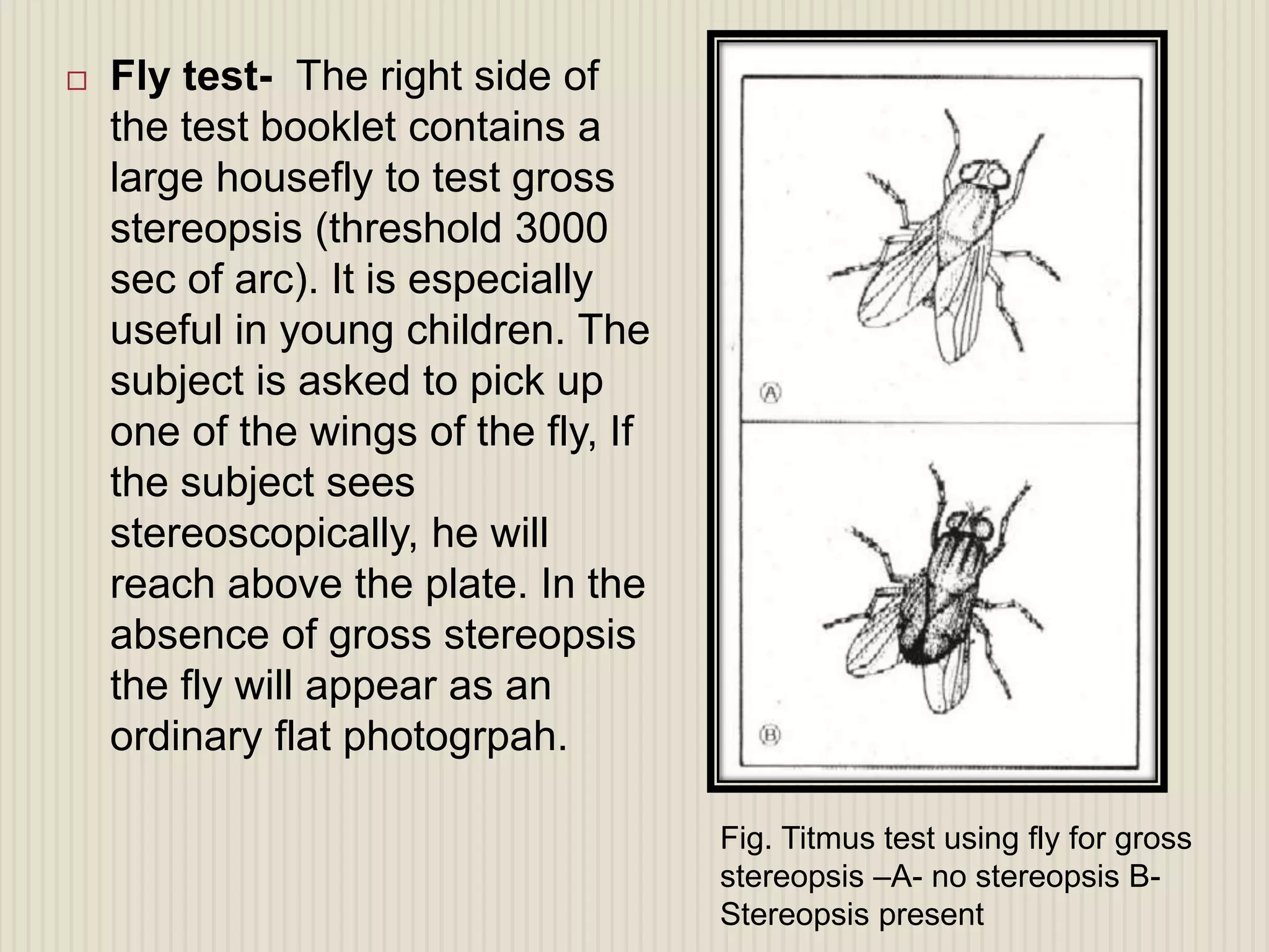 Evaluation of squint | PPTX