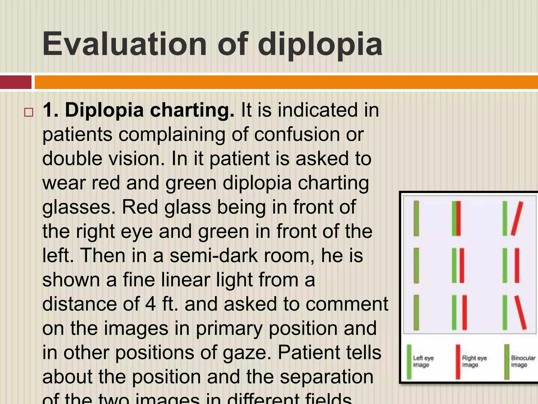 Evaluation of squint | PPTX